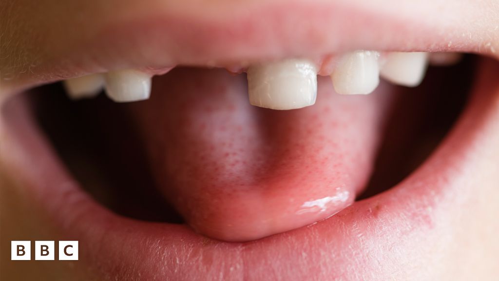 Happy Gappy Smiles - CBeebies