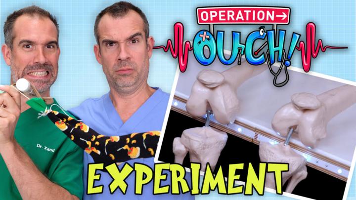 Operation Ouch! Do Try This At Home: Kneecap Challenge experiment - Dr ...