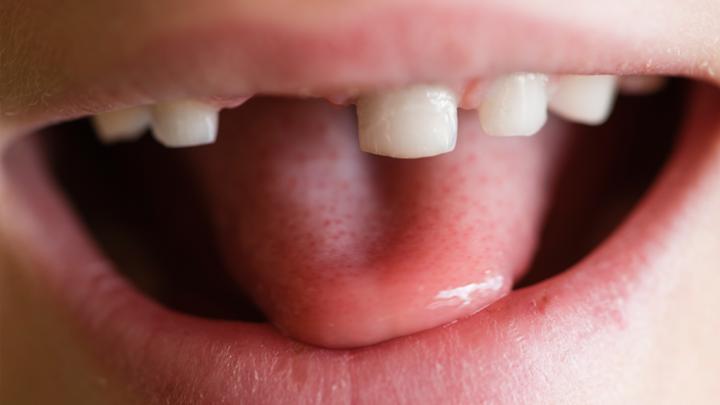 Happy Gappy Smiles - CBeebies - BBC