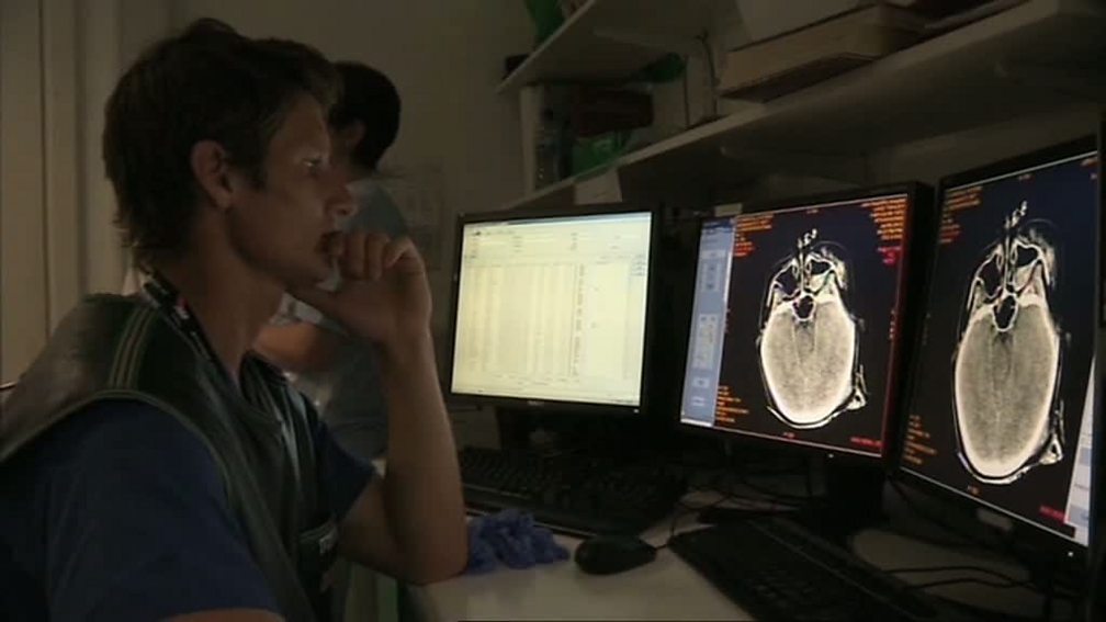 BBC Two - Brain Doctors