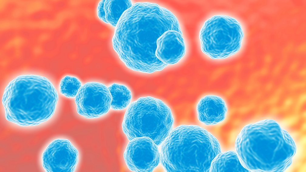 BBC Radio 4 - File on 4 Investigates, Superbugs