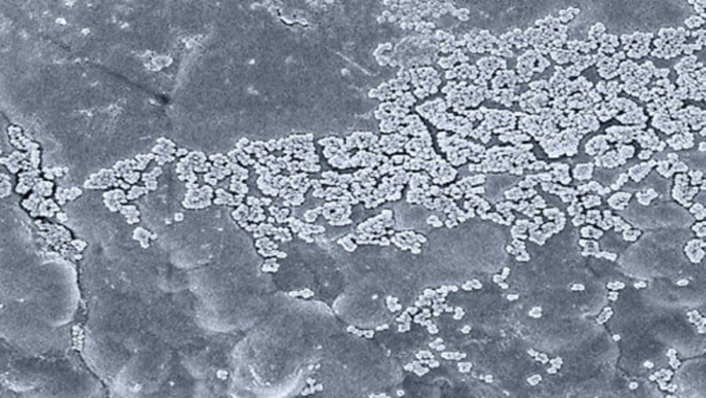 BBC One - State of the Planet, IS THERE A CRISIS?, Bacterial world