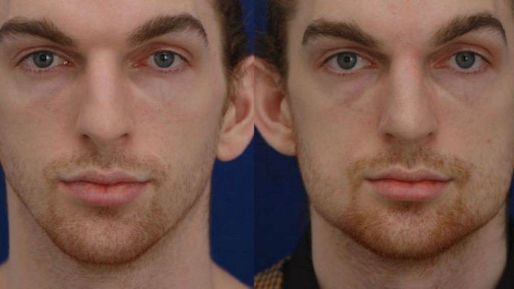 BBC World Service - Newsday, Is social media fueling a craze for ...