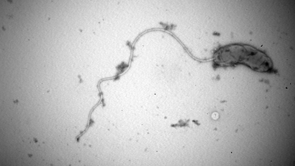 BBC Radio 4 - The Life Scientific, Liz Sockett on friendly killer bacteria