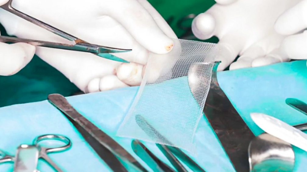 BBC Two - Victoria Derbyshire, 26/06/2017, NHS hernia mesh 'leaving ...