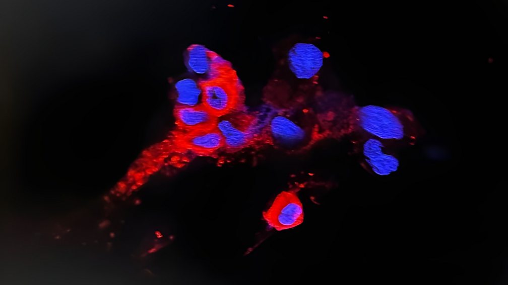 BBC World Service - Health Check - Downloads