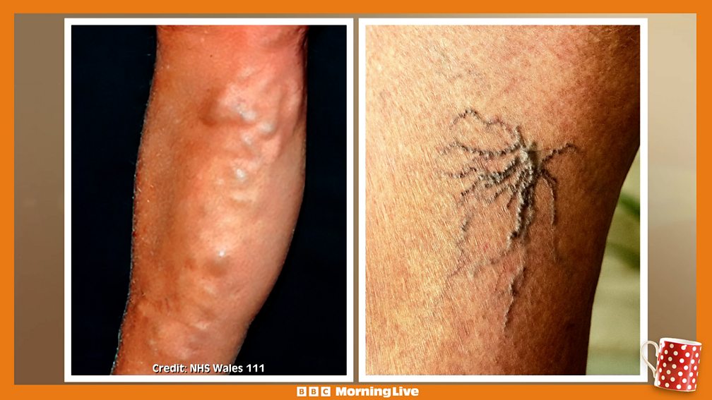 BBC One - Morning Live - Dr. Ranj