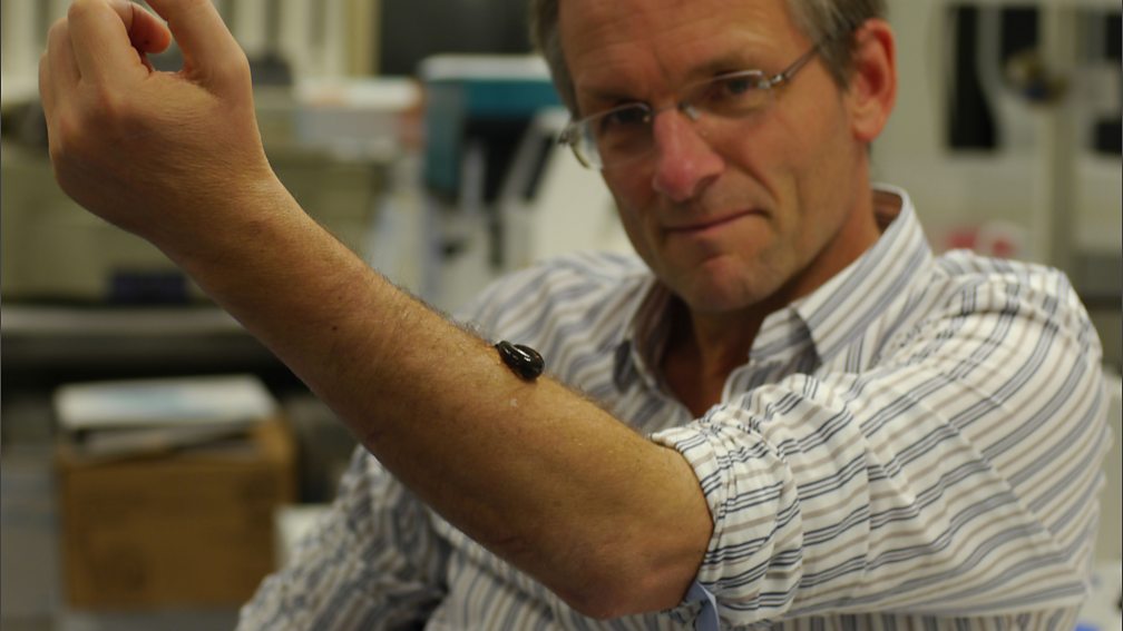 BBC Four - Infested! Living with Parasites