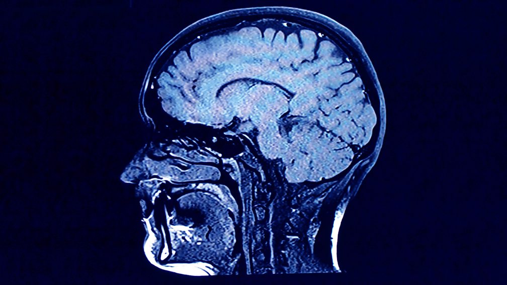 The atomic 'bomb spike' in your body