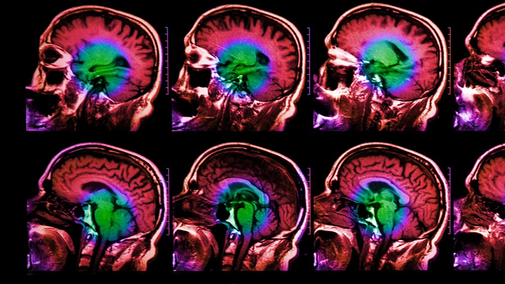 The Documentary - Neurolaw and Order - BBC Sounds
