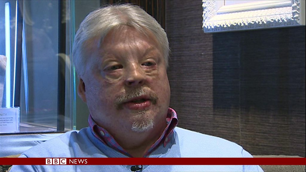 Falklands War ‘true hero’ Royal Navy medical officer Captain Rick Jolly ...