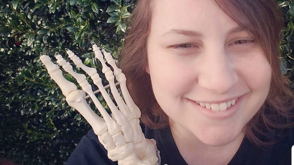 Newsday - The woman who's dedicated her Instagram to her amputated foot ...