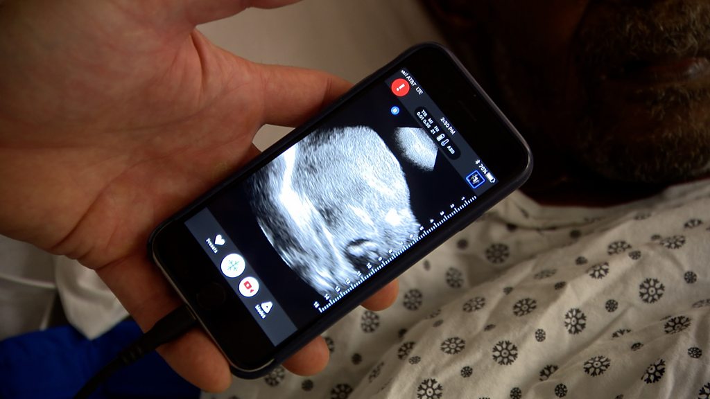 O ultrassom portátil de baixo custo que promete revolucionar medicina ...