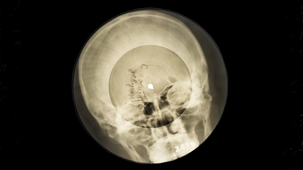 Between the Ears - Bone Music - BBC Sounds