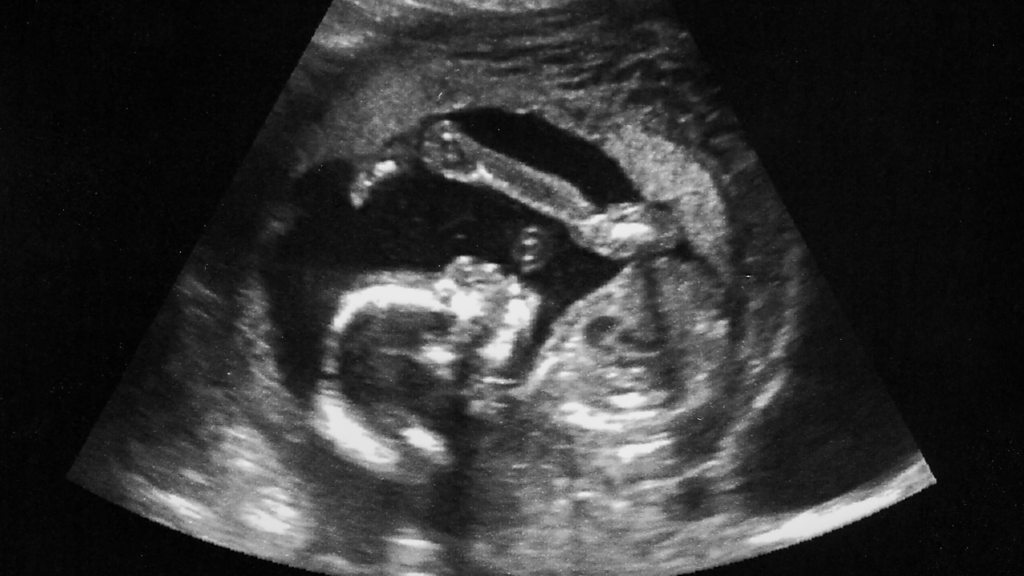 Analysis - Why worry about future generations? - BBC Sounds