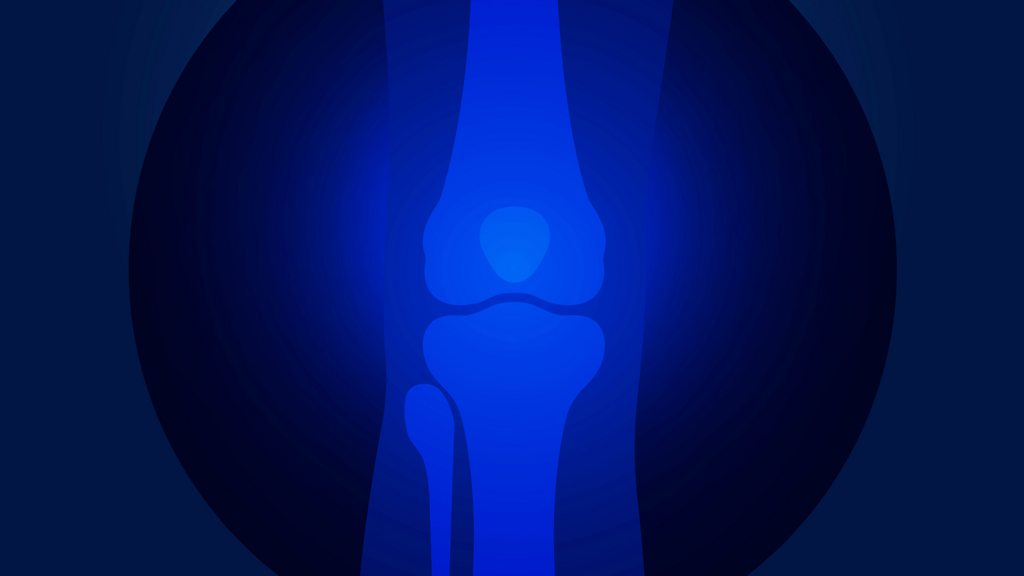 Unexpected Elements - Bone repair from Covid-19 vaccine technology ...