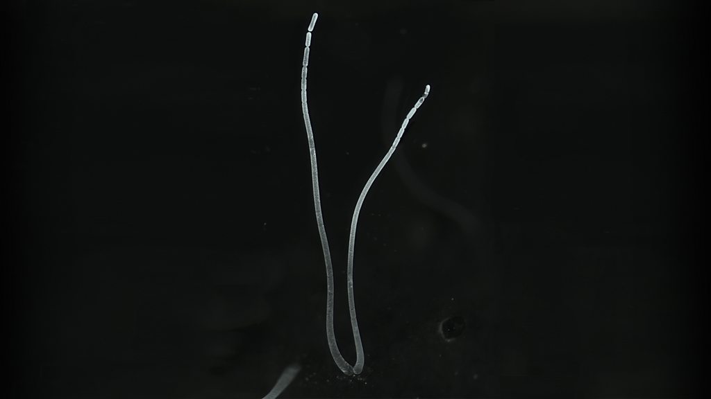 Unexpected Elements - Monster microbe - BBC Sounds