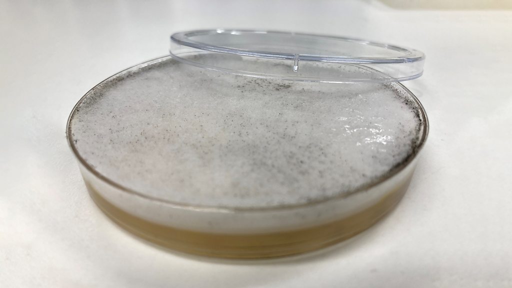 Inside Health - Is a fungal pandemic possible? - BBC Sounds