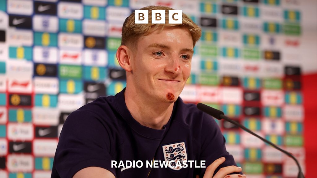 Gordon: Lack of game time, bike injuries & England criticism - BBC Sounds