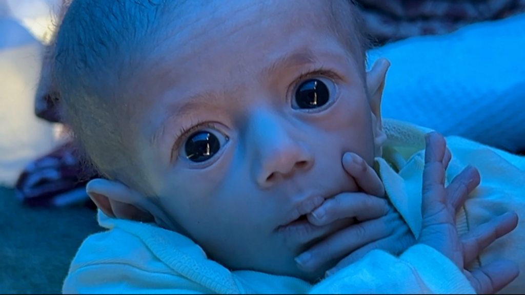Starving White Kids
