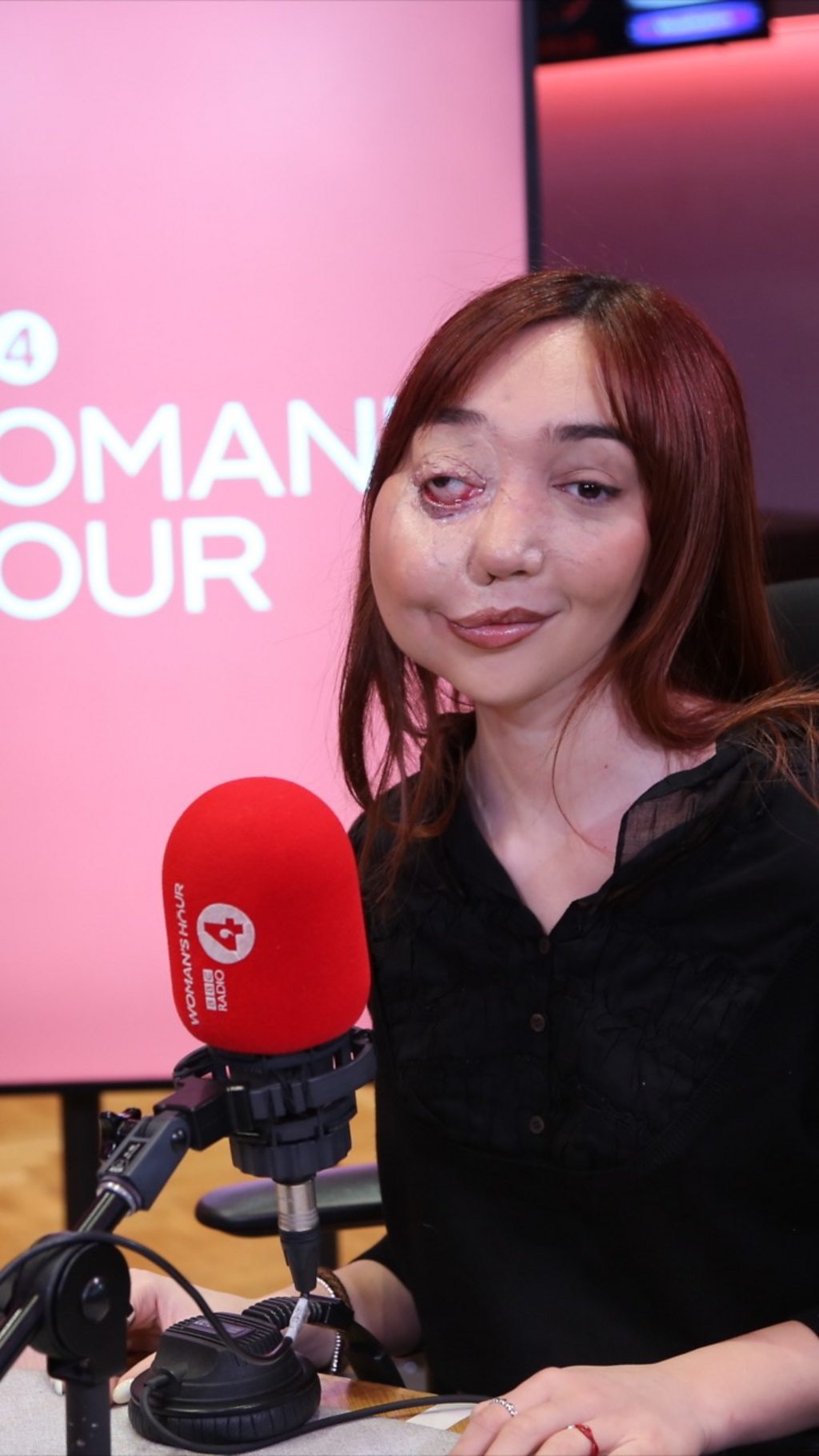 Nikki Lilly: Self-acceptance is a 'real work in progress'