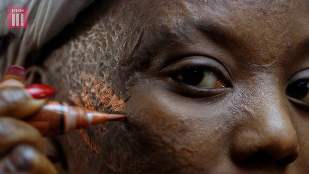 The scars that won't stop me being me - Bobby's story - BBC Three