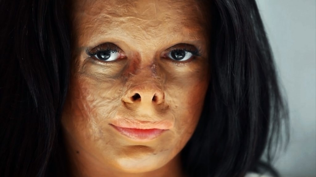 If I get plastic surgery, will it affect my baby? - BBC Three