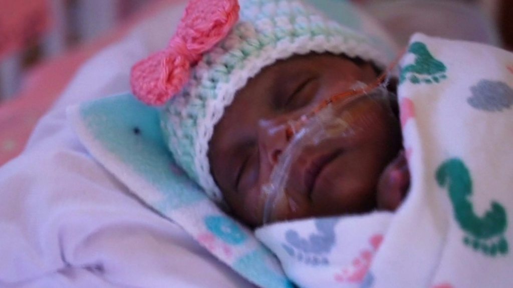 World's tiniest tot goes home