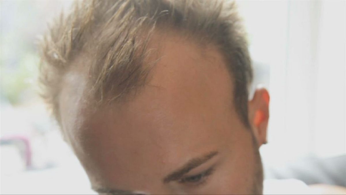 BBC Three - Inside the Body Beautiful, Episode 1, What is hair and how ...