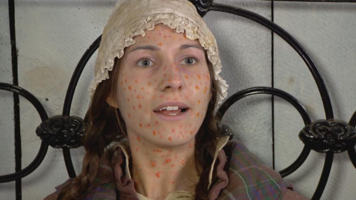 BBC Two - Victorian Scotland, Common Victorian diseases and social ...