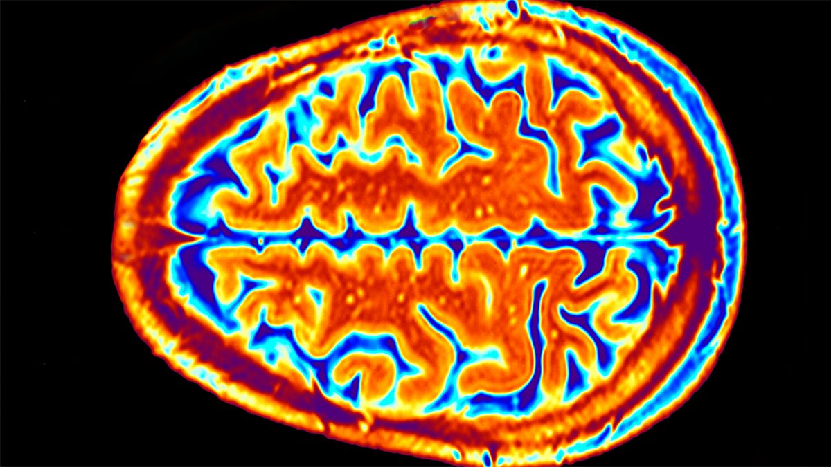 BBC Radio 4 - BBC Inside Science, 2D supermaterials; Inside an MRI ...
