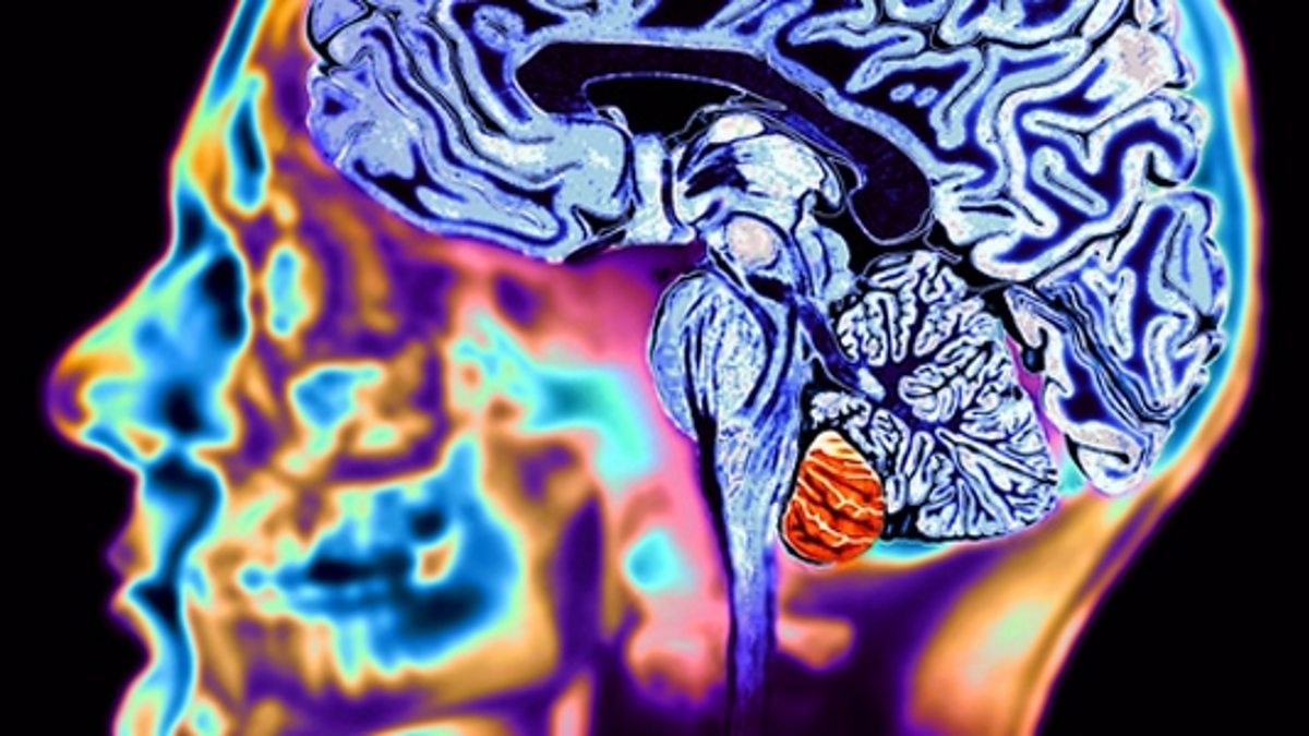 BBC World Service - The Documentary, The Mysteries of the Brain