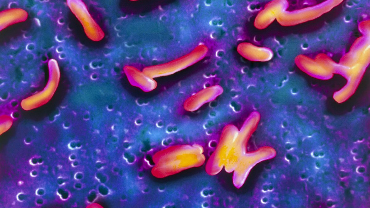 BBC World Service - Science In Action, 11/08/2011