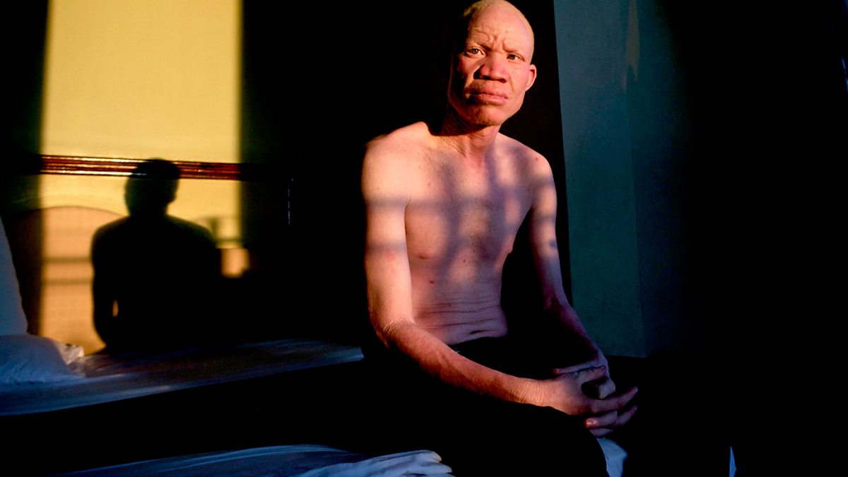 Bbc Four Storyville Albino Witchcraft Murders