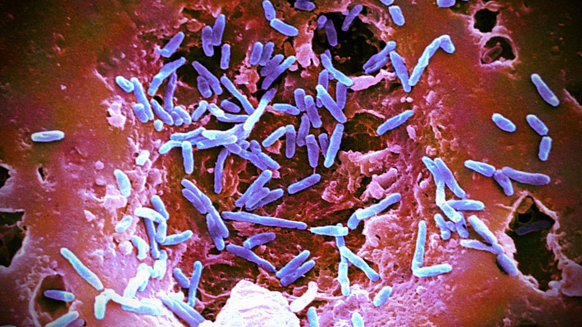 BBC World Service - Discovery, Gut Microbiota