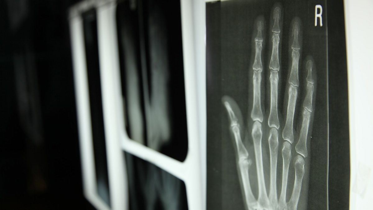 BBC Four - Dissected, Inside the Dissected lab - Hand x-rays in the ...