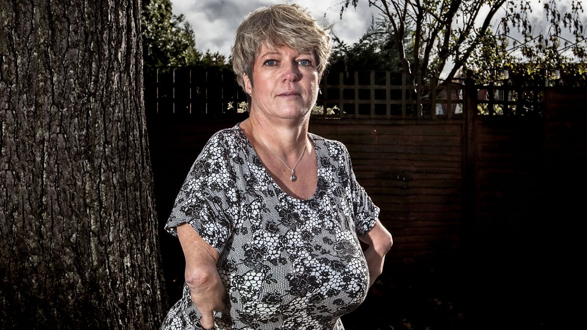 BBC Two - Thalidomide - The Fifty Year Fight