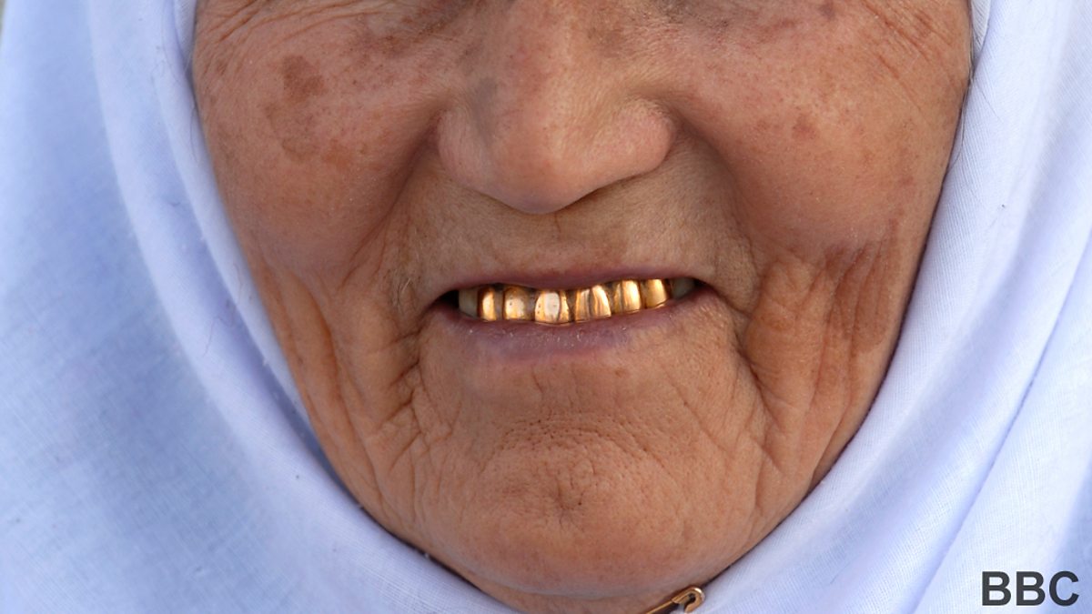 BBC World Service - The Forum, Gold, Why gold makes good teeth
