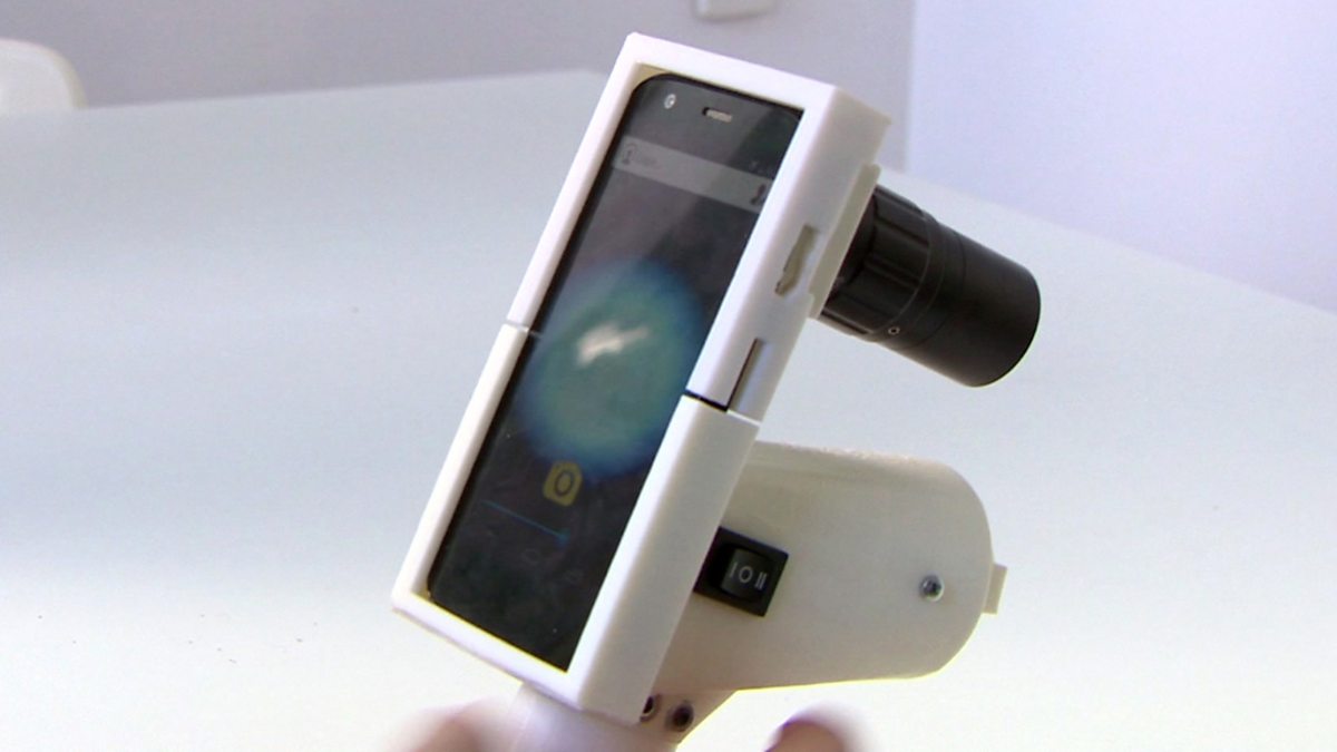 BBC News - Click, 31/05/2014 GMT, The handheld cancer detector