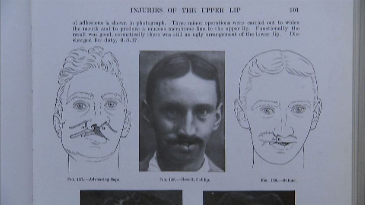 BBC One - Antiques Roadshow, Series 34, Remembrance Special, Antiques ...