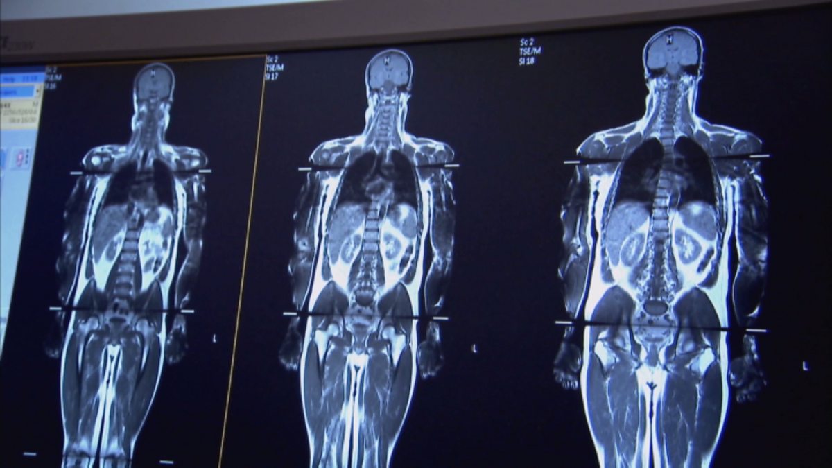 BBC - Learning, The men who made us fat