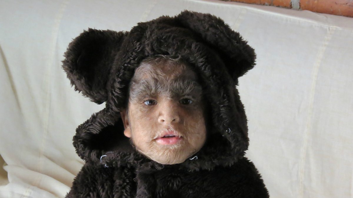 BBC World Service - World Update, The world's only 'wolf' family