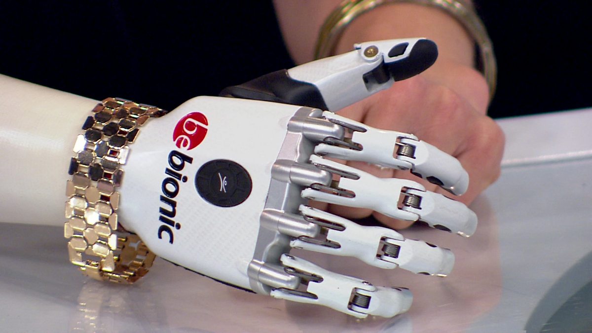 BBC Two - Victoria Derbyshire, 18/06/2015, First prosthetic limb ...