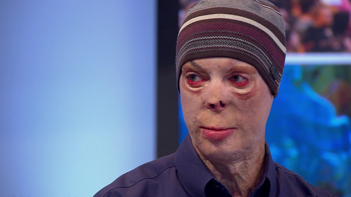 BBC Two - Victoria Derbyshire, 25/06/2015, ‘I officially died three ...