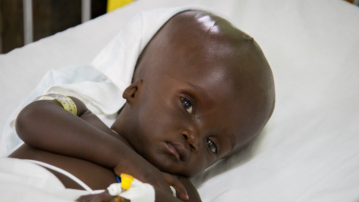 BBC World Service - Boston Calling, The Drug Store Edition, A ...