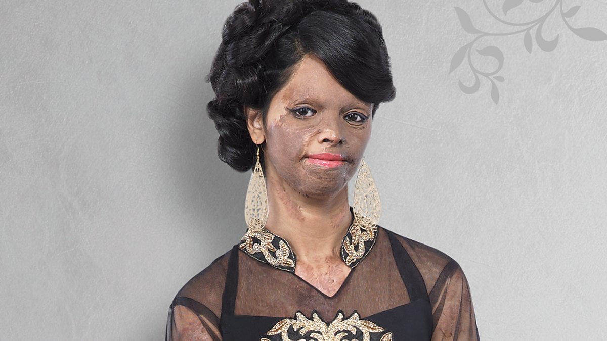 BBC World Service - Outlook, Acid Attack Survivor Signed as Model