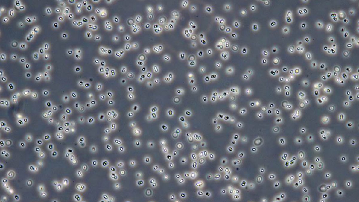 BBC World Service - The Forum, Living at the Edge: Life in Extreme ...