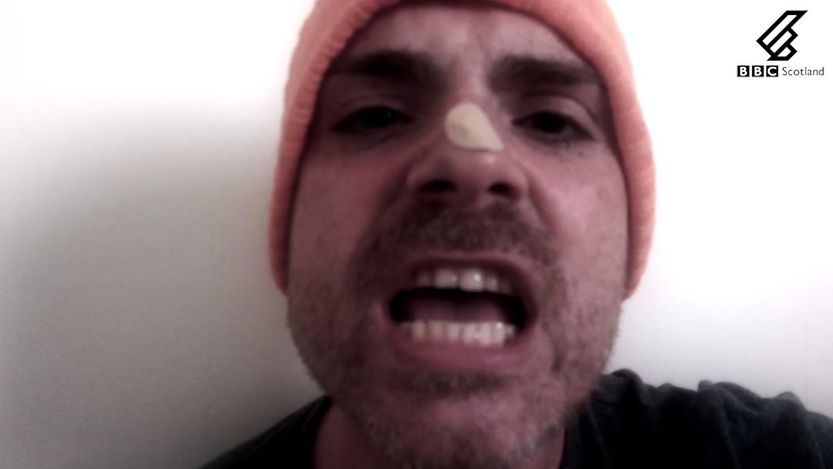 BBC Scotland - Short Stuff, Ranting Scotland fan Rab Gillespie ...