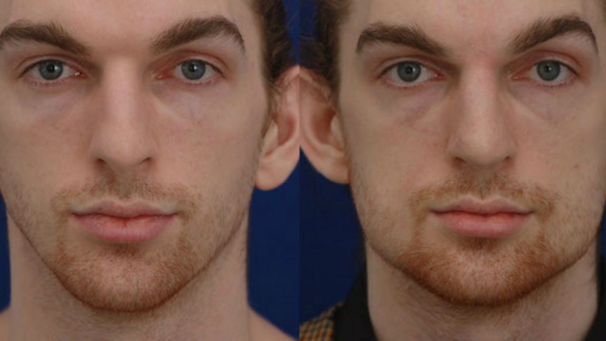 BBC World Service - Newsday, Is social media fueling a craze for ...