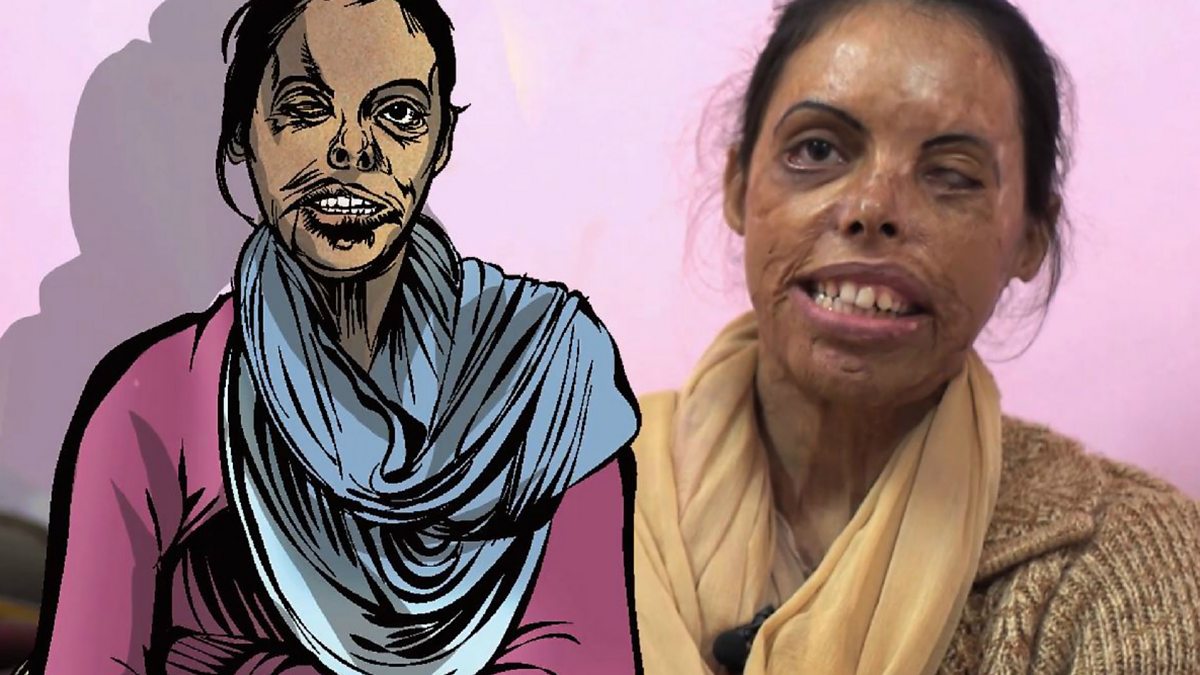 BBC World Service - Newsday, Acid-attack survivors: heroes not victims